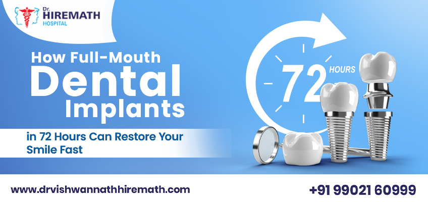 Restore Your Smile in 72 Hours | Dental Implants Bangalore | Dr ...