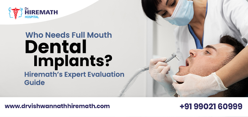 Who Needs Full Mouth Dental Implants? Expert Guide by Dr. Hiremath | Dr ...
